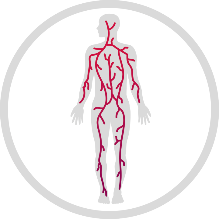 Lymphoedema Service - Provide